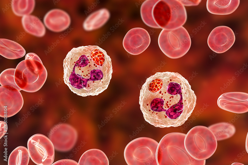 Poster Anaplasma bacteria infecting neutrophils, causing various tick ...