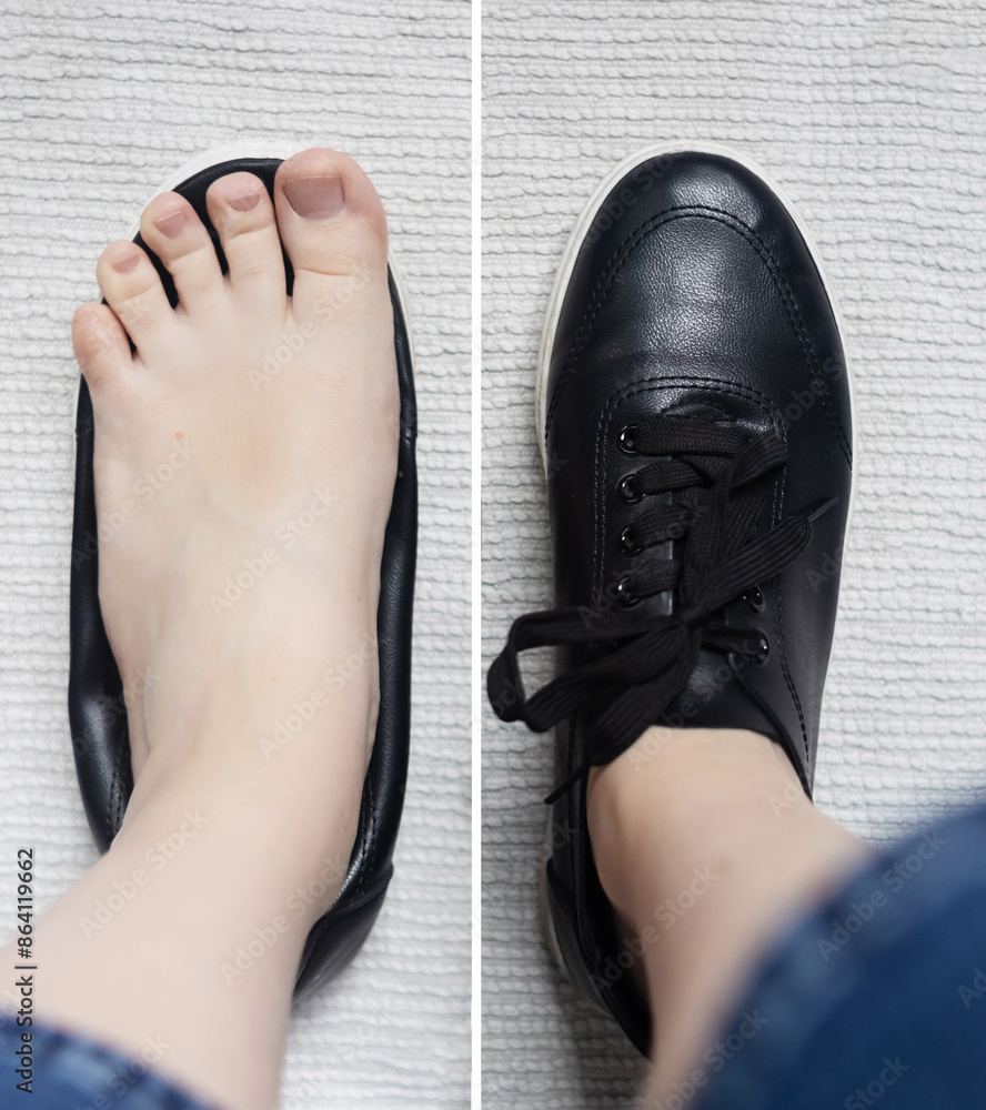 Foot deforming shoes. Incorrect anatomical shoes with flat soles. Small ...