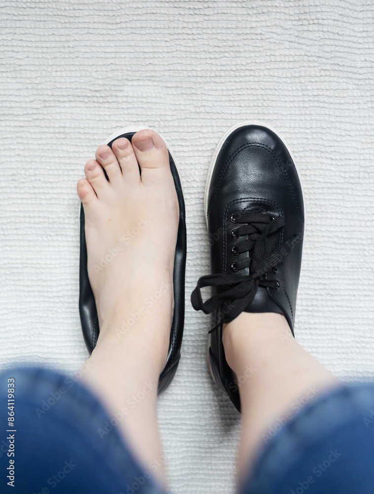 Foot deforming shoes. Incorrect anatomical shoes with flat soles. Small ...