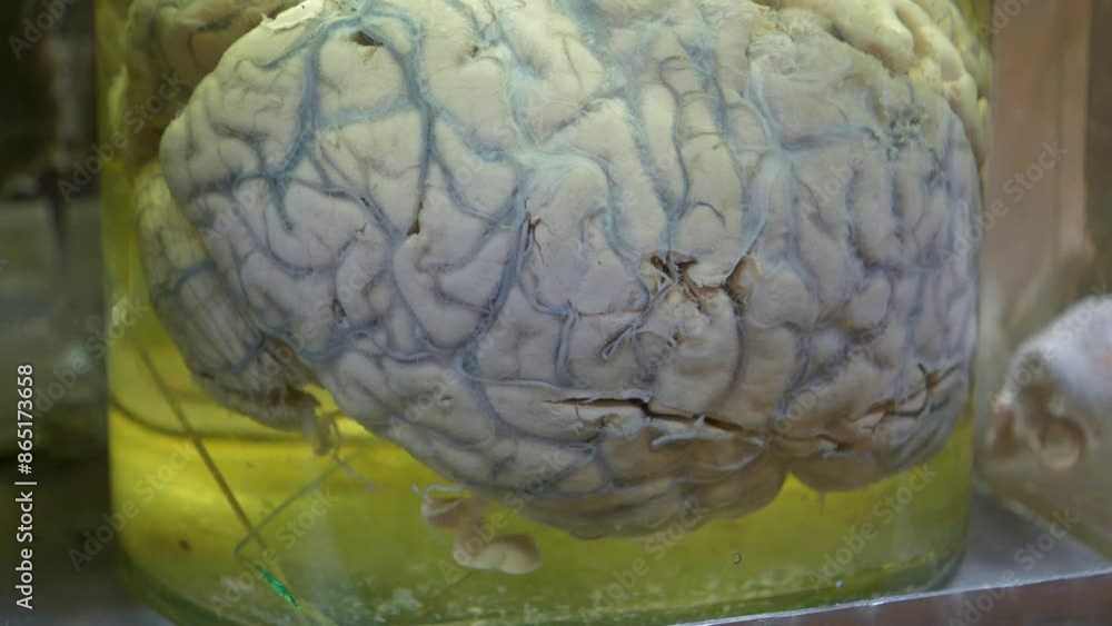 Real human brain, grey matter. Human brain in glass jar with ...