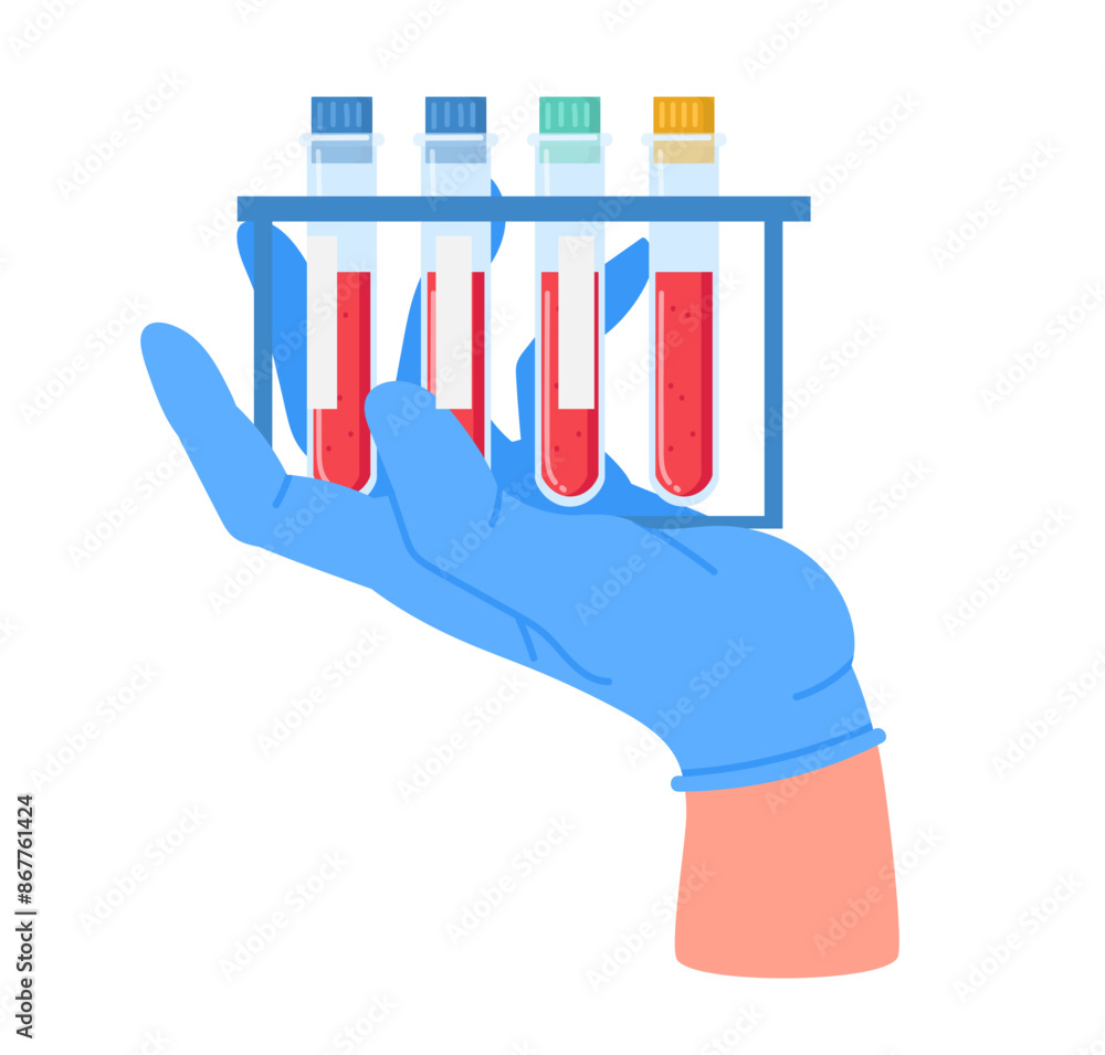Lab worker hand holding blood samples. Doctor hand in rubber gloves ...