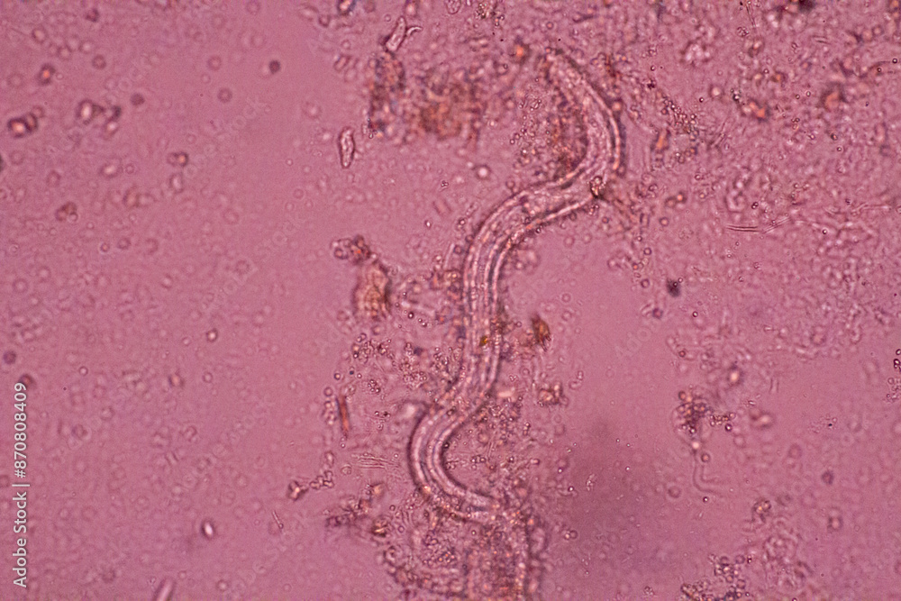 View in microscopic Strongyloides stercoralis or threadworm in human ...