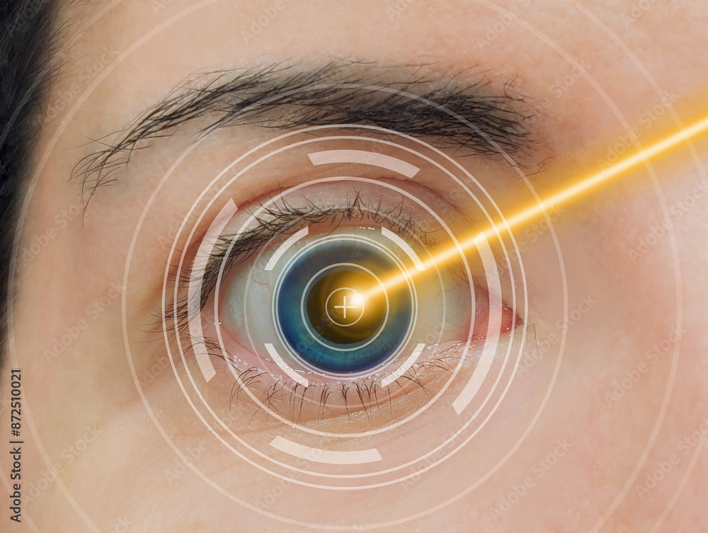 Close-up of blue eye with digital guides treated with yellow diode ...