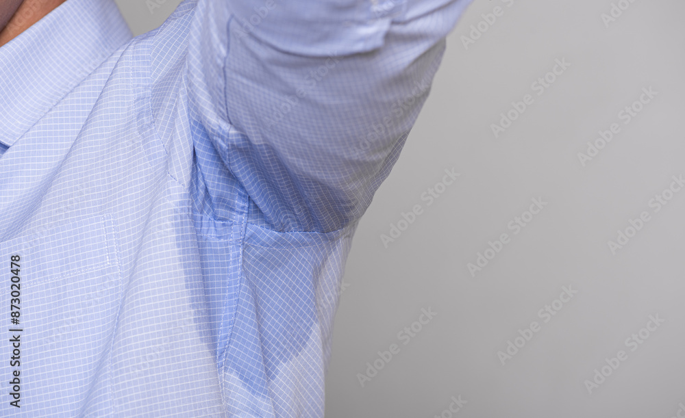 Poster Close-up man with hyperhidrosis sweating – Wall Art | UkPosters