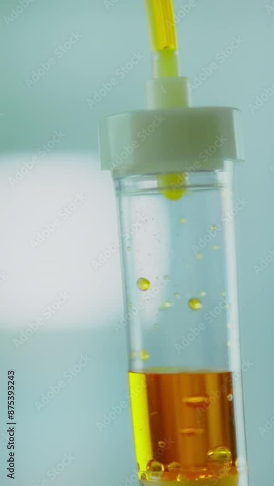 Vertical monitor. A close-up shows medical fluid dripping from a bag ...
