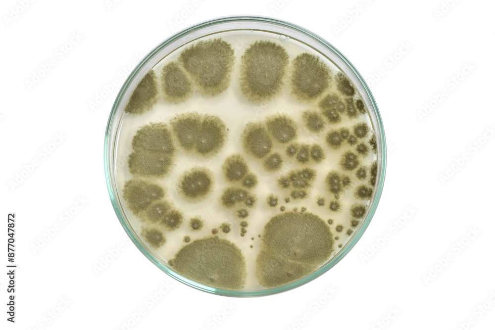 Colony morphology of Yeast and mould. Fungal colony morphology. Fungal ...