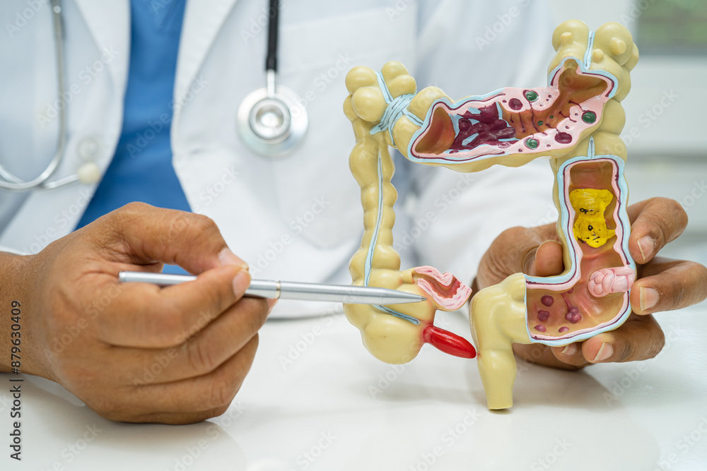 Intestine, appendix and digestive system, doctor holding anatomy model ...