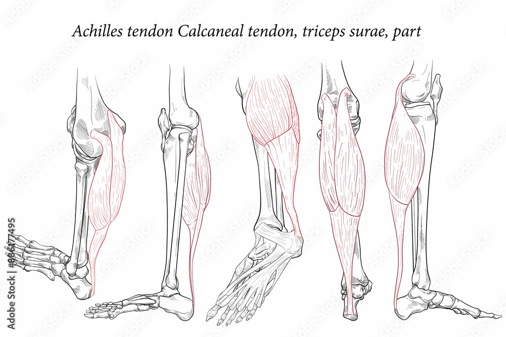 Medical illustration side view of Foot Achilles tendon Calcaneal tendon ...