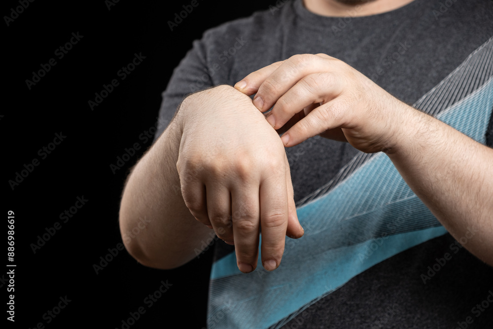 Foto de Ganglion cyst or hygroma of the wrist on the hand of a male ...
