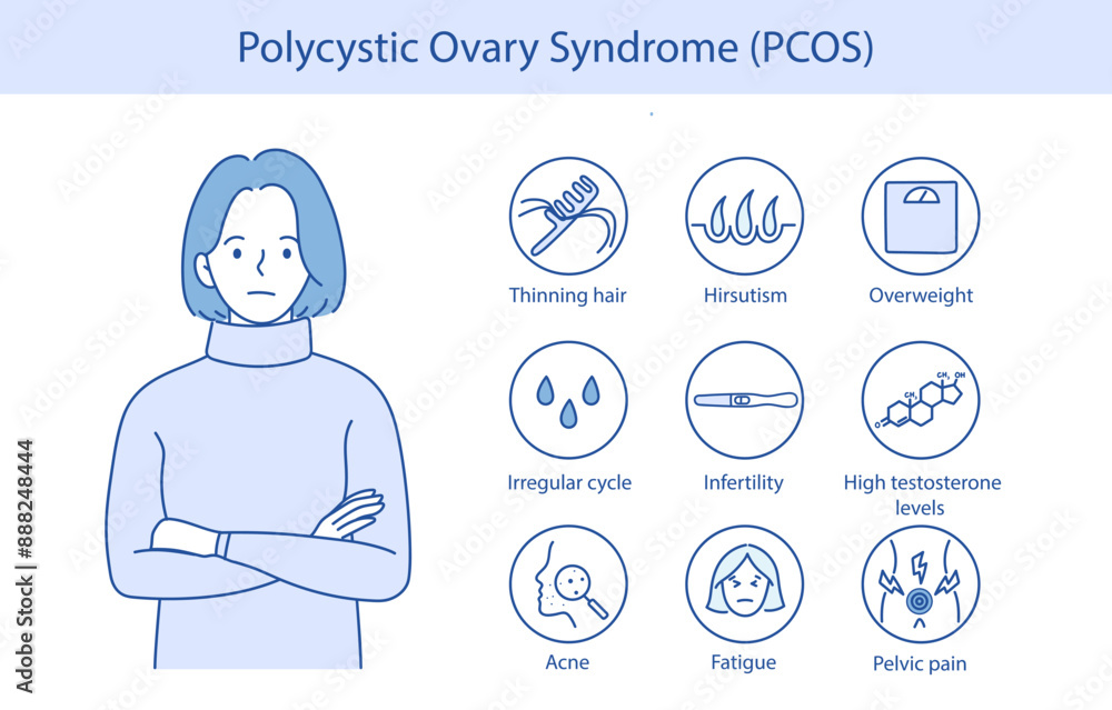 Polycystic ovary syndrome PCOS. Ovarian cysts of the female ...