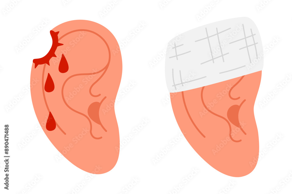 Injured ear with blood drops and and Bandaged human ear. Ear bandage ...