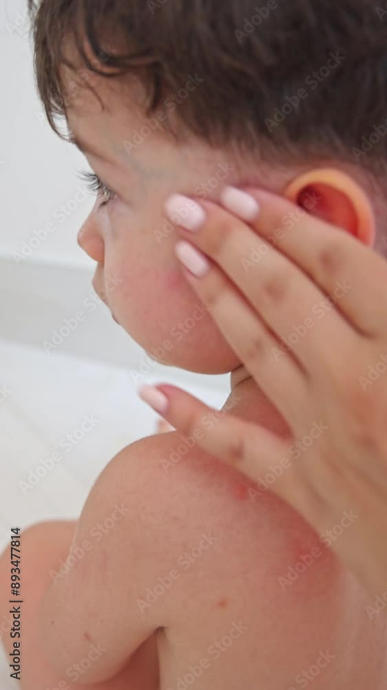 kid with lot of insects, mosquito, fleas or other parasites bites on ...