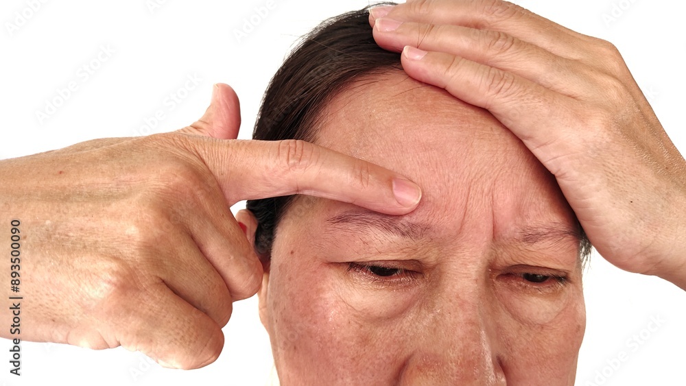 Woman with headache, stress and serious, wrinkles and flabby skin ...