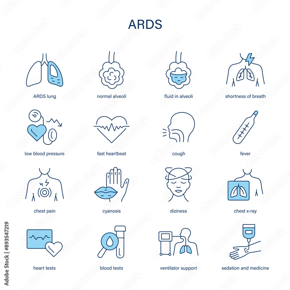 ARDS, Acute Respiratory Distress Syndrome symptoms, diagnostic and ...