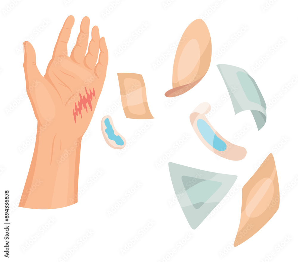 Hand injured skin and procedures of bandaging and wound cleaning. First ...