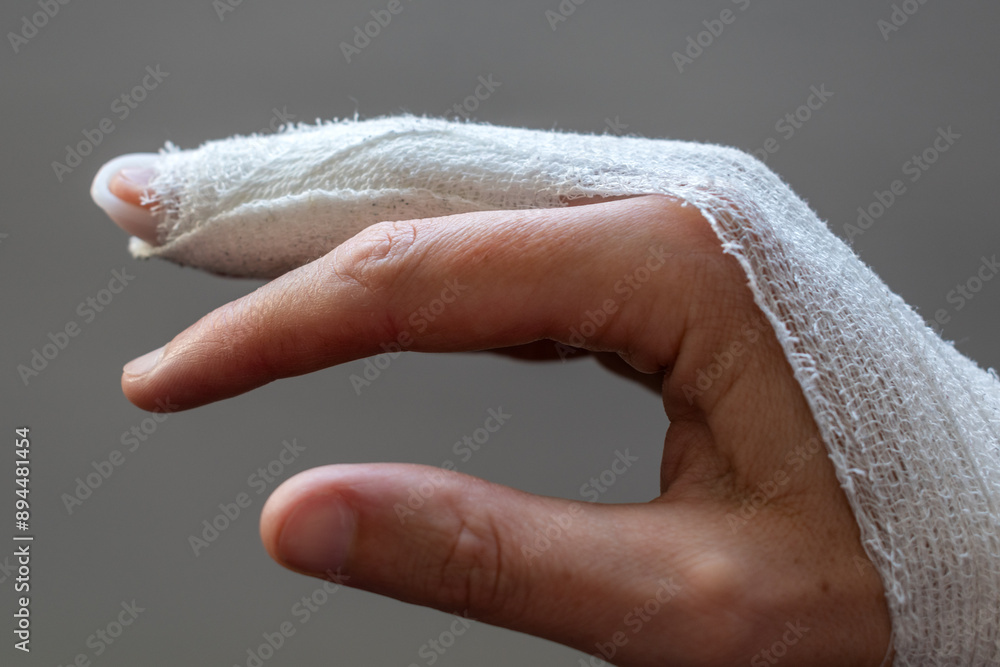 Foto de Mallet finger, stack splint on the middle finger with bandage ...
