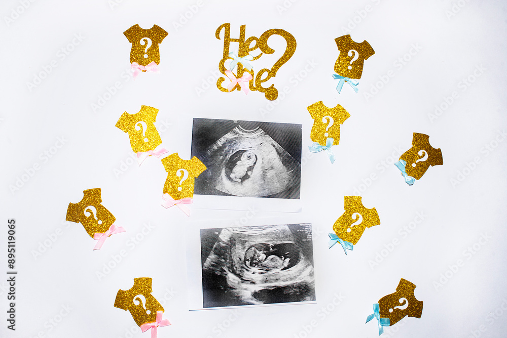 Pregnant woman ultrasound photo and question mark on white background ...