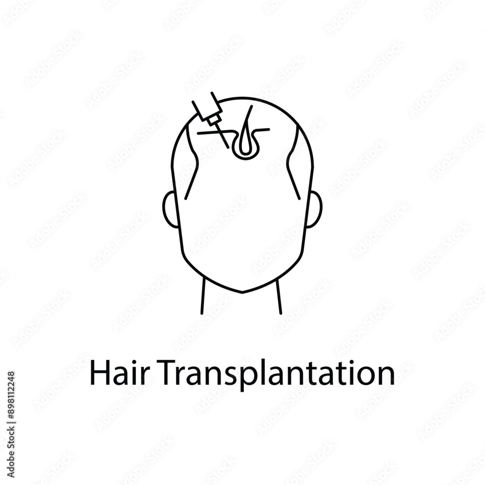 Hair Transplantation, Hair Restoration, Hair Surgery, Cosmetic Surgery ...