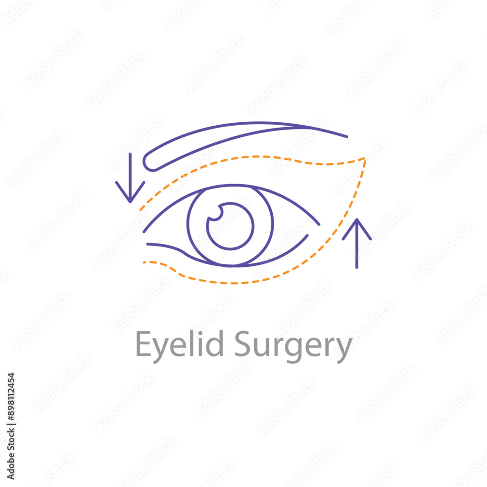 Eyelid Surgery, Blepharoplasty, Eye Lift, Cosmetic Surgery, Eyelid Lift ...