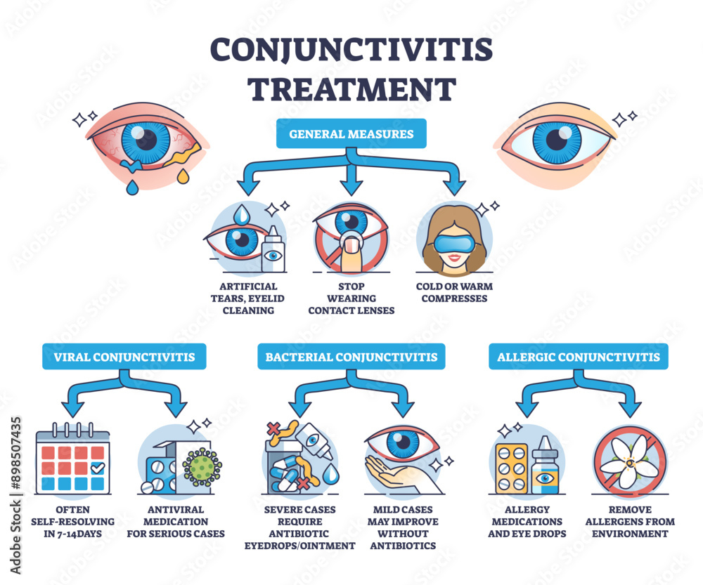 Conjunctivitis treatment with medicines and medical help outline ...