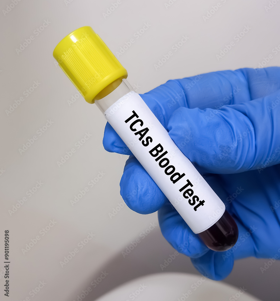 Blood sample for Tricyclic antidepressant (TCA) drug test. It's ...