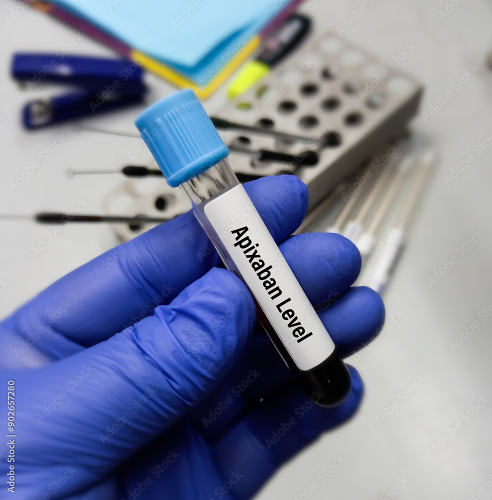 Blood sample for Apixaban level test. Measurement of drug level in ...
