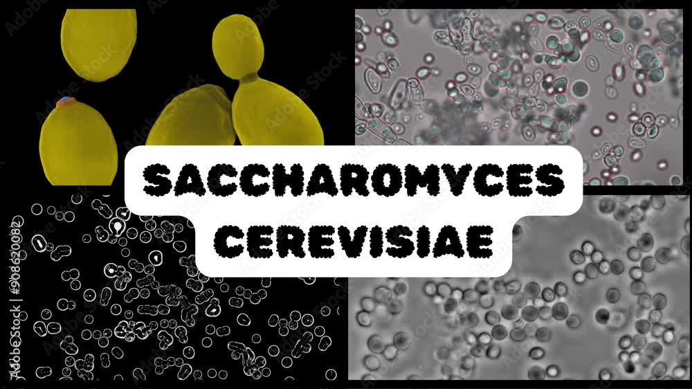 yeast cells microscope view, probiotic yeast cells and Saccharomyces ...