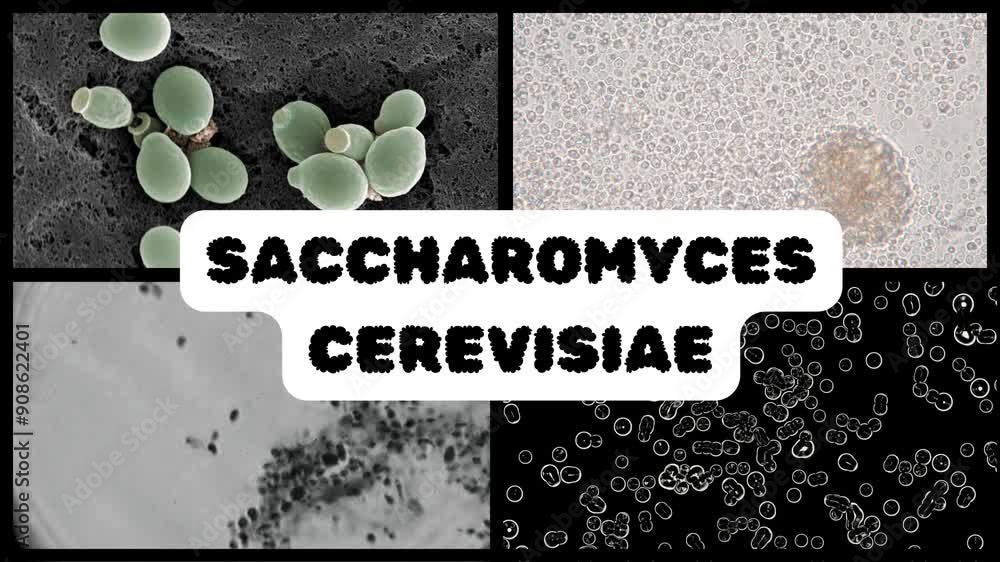 yeast cells microscope view, probiotic yeast cells and Saccharomyces ...