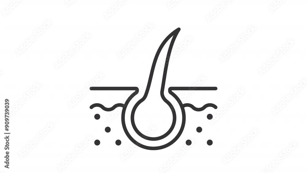 Hair growth line animation. Scaling follicle animated icon. Scalp ...
