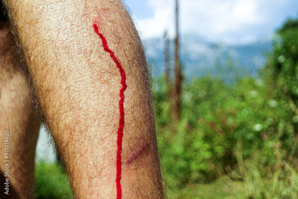 Foto de Blood on a hairy male leg: a close-up photo of a bleeding small ...