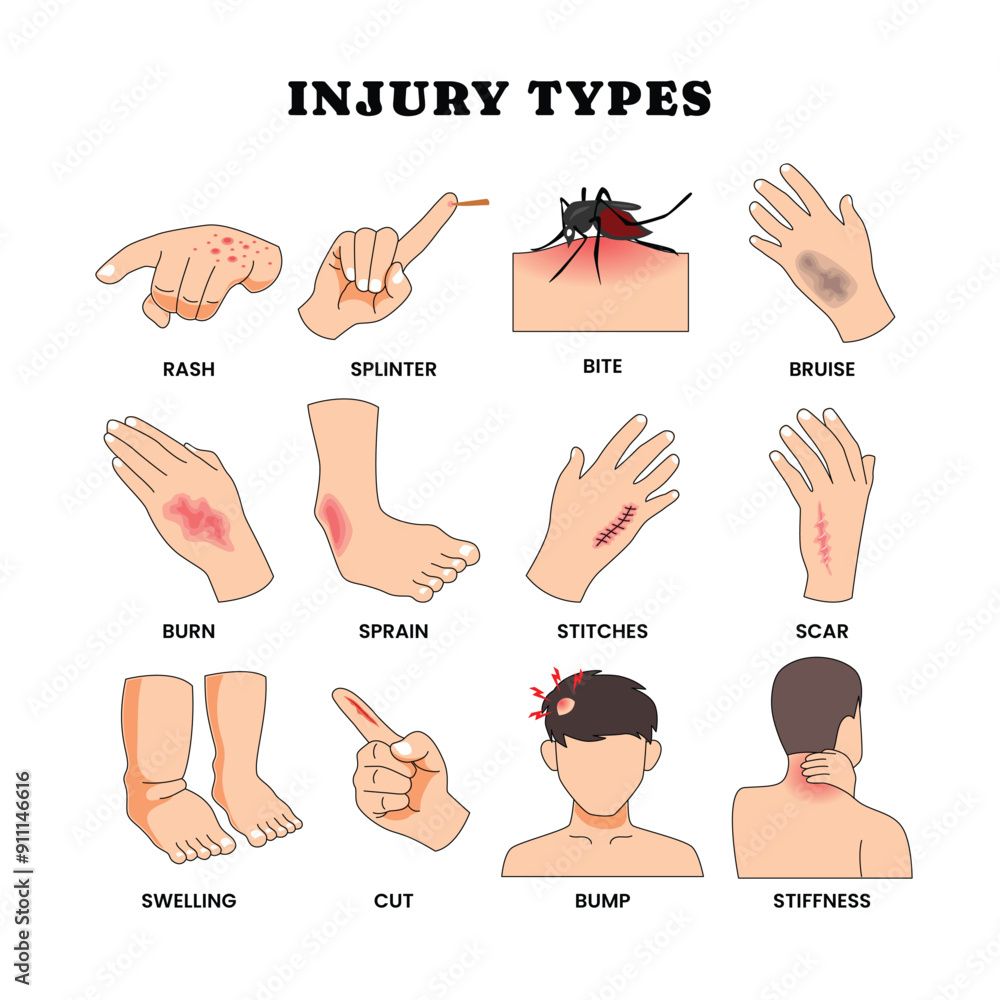 Different types of physical injury types poster for education vocabulary words with rash ...