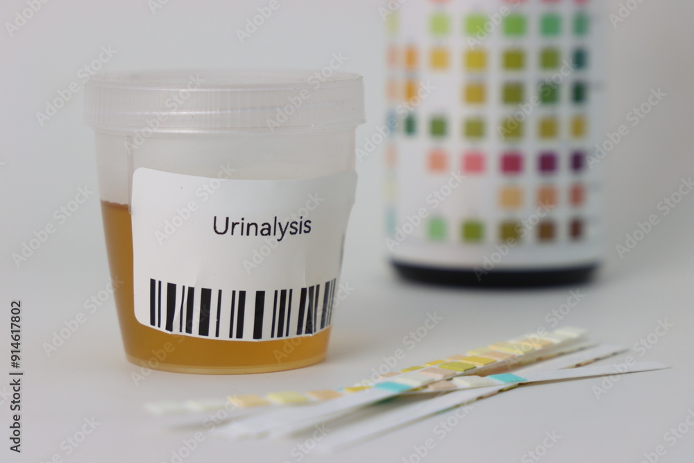 Urine sample in a bottle in a white surface with reagente strips for ...