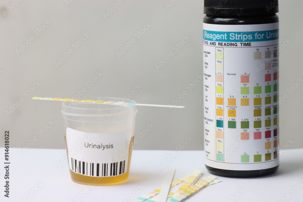 Urine sample in a bottle in a white surface with reagente strips for ...