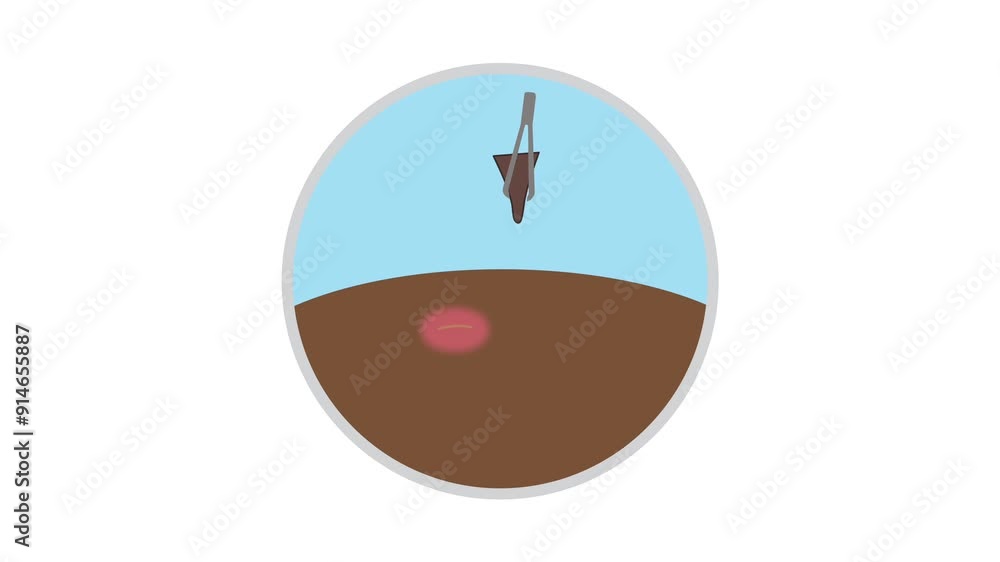Sting removal animation. Tweezers appearing on screen, removing a wasp ...