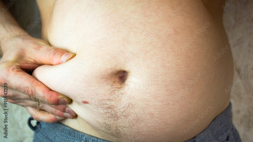Abdominal folds in a young man, fullness, overweight, full man belly ...