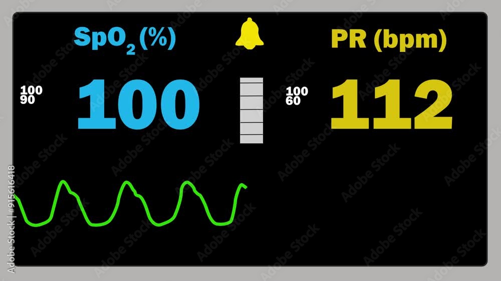 Pulse oximetry monitoring equipment screen - value of SpO2, saturation ...