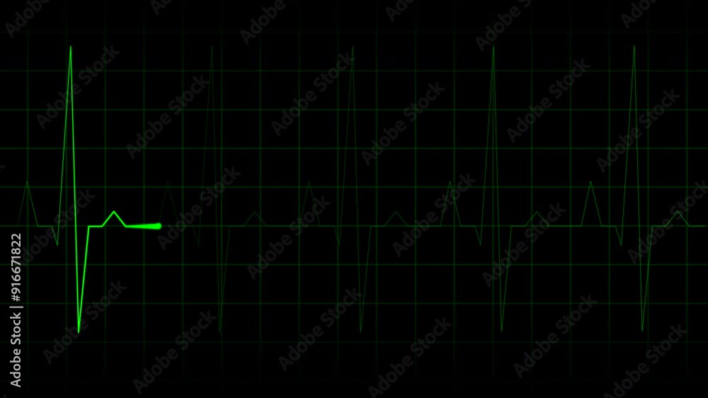 Neon heartbeat on black isolated background. ECG cardiogram ...