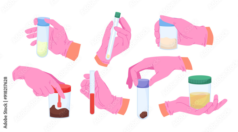 Doctors hands in green gloves holding containers with samples of urine ...