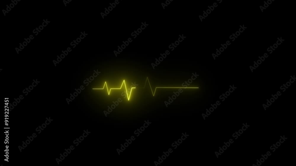 ECG cardiogram oscilloscope. Heartbeat line showing.Heart beat ...