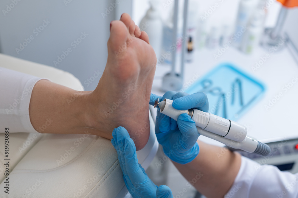 The podologist treats the feet using electric device machine. Patient ...