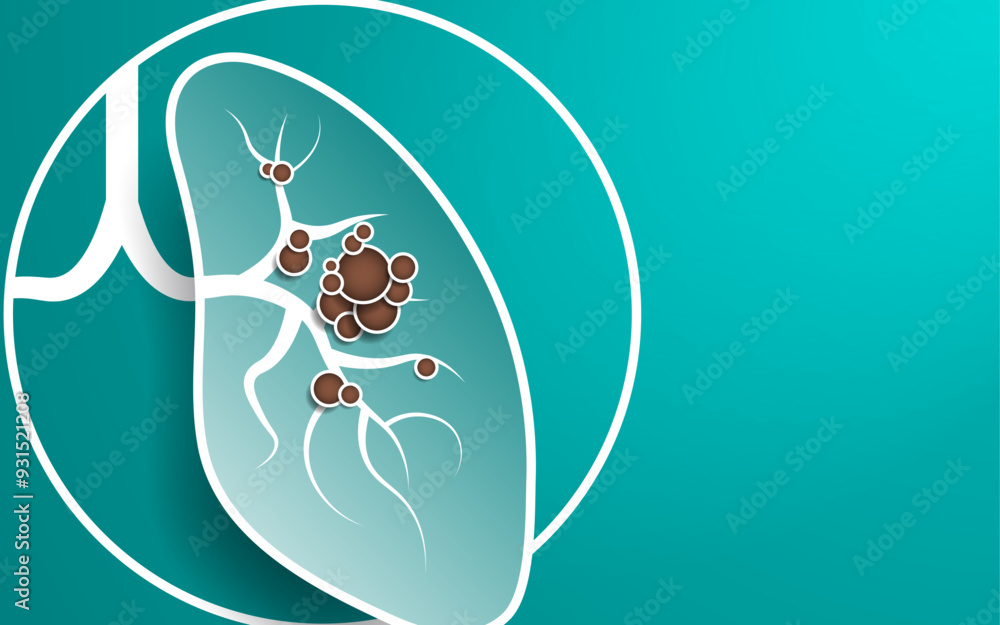 =3D Paper Cut Left Lung dotted with red tumor bacteria infection spread ...