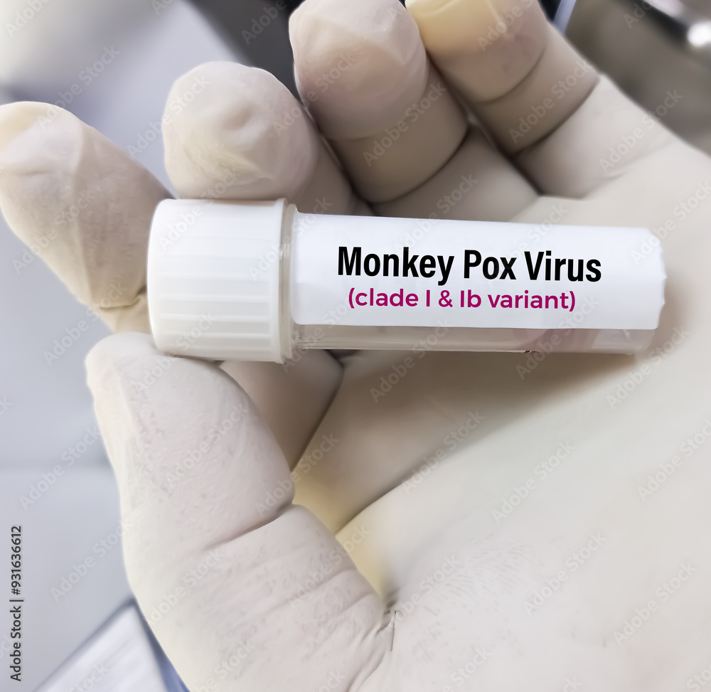 Blister swab or nasal swab sample for monkey pox virus (MPXV) test ...