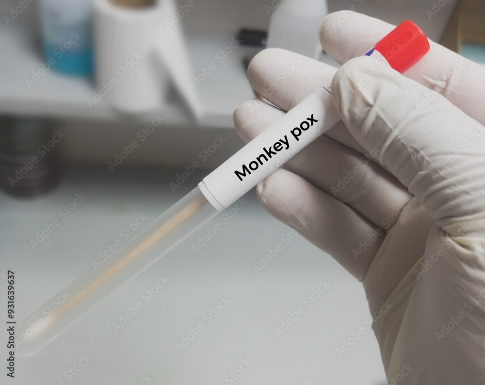 Blister swab or nasal swab sample for monkey pox virus (MPXV) test ...