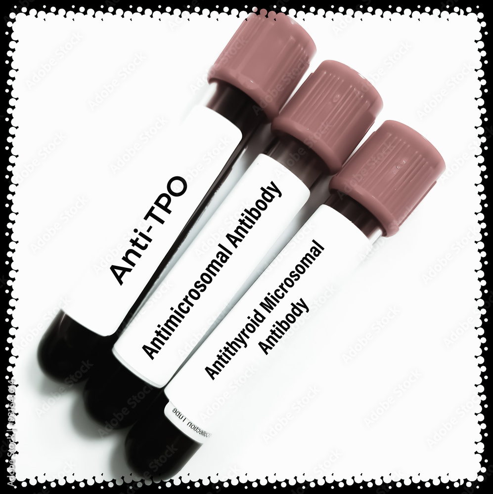 Blood sample for Thyroid Peroxidase Antibodies or Anti-TPO test and ...