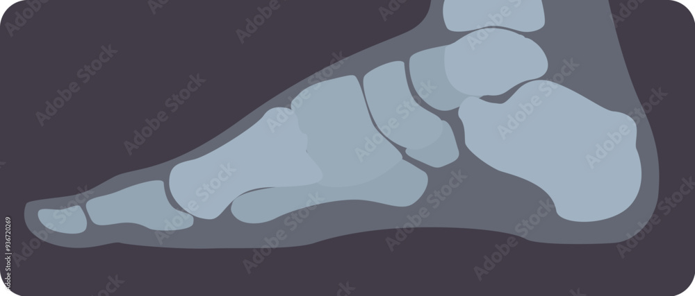Vetor de Lateral radiograph of human foot or limb. X-ray picture or ...