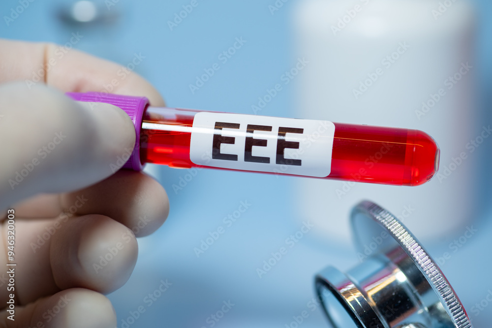 Eastern Equine Encephalitis (EEE) is an extremely rare but serious and ...