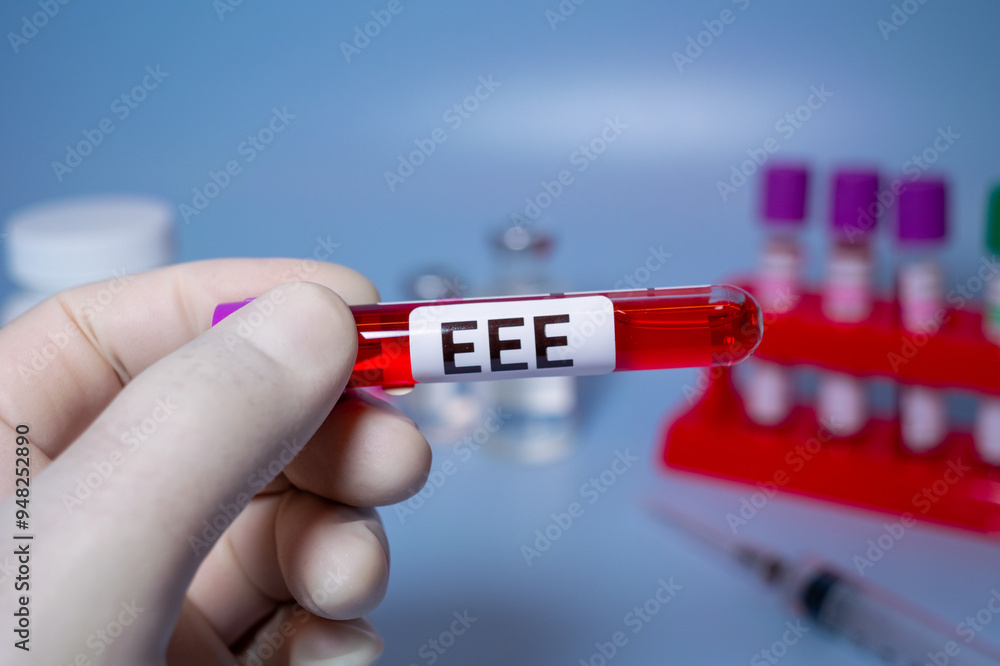 Eastern Equine Encephalitis (EEE) is an extremely rare but serious and ...