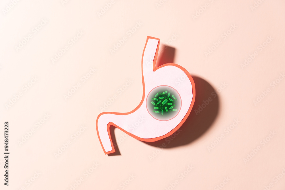 Helicobacter pylori bacteria infects human stomach. H.pylori infections ...