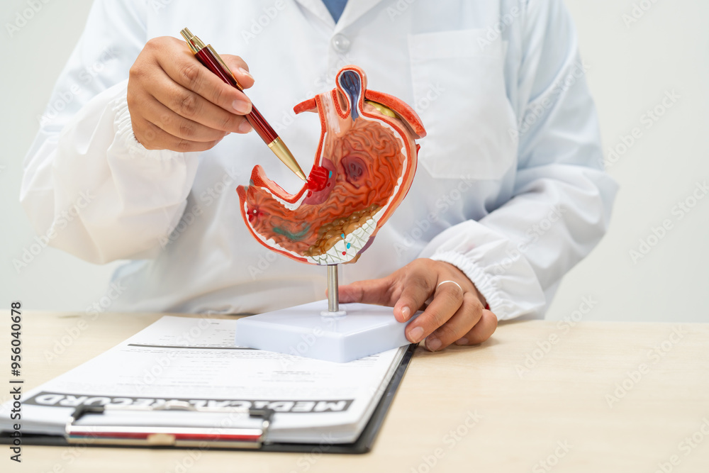 A female doctor a hospital desk discussing digestive disorders such as ...
