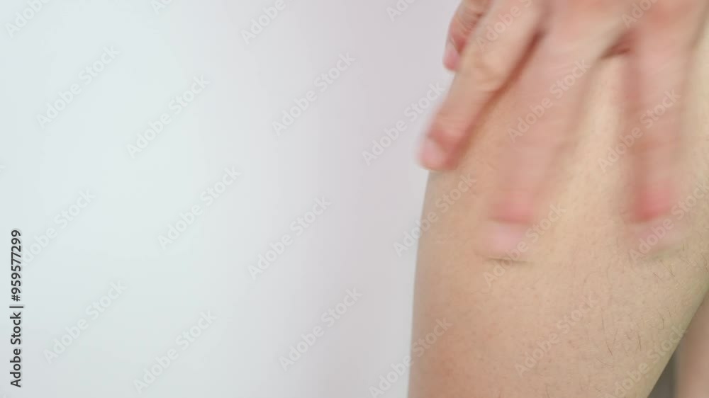 Someone scratching wound on leg caused of Mosquito bites. Mosquito ...